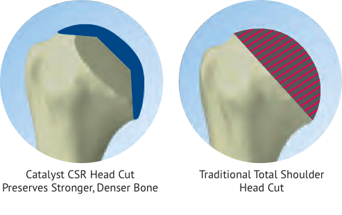 Shoulder Treatment in Muskegon & Grand Haven, MI | Orthopaedic ...
